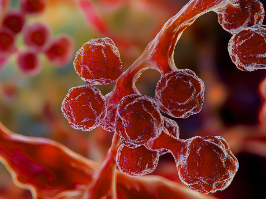 33468/33519 - Histoplasma qPCR (Lower respiratory) & Histoplasma qPCR ...