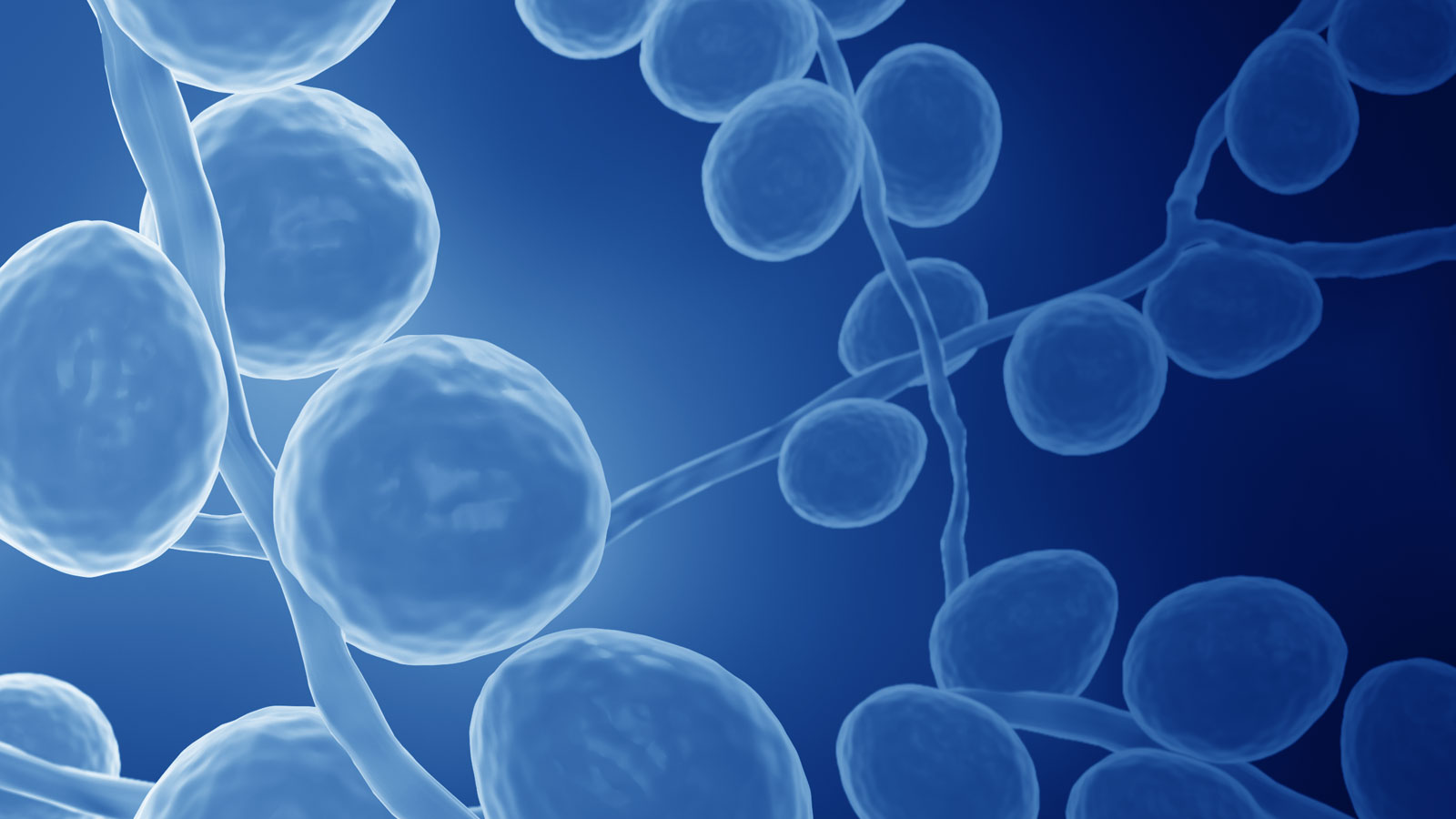 PFL8036 - Fungal Plus Profile II (bronch wash) | Clinical | Eurofins ...