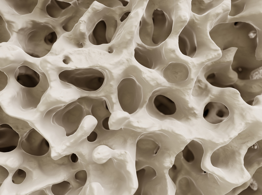 GVHD Biomarkers & Diagnosis | Eurofins-Viracor